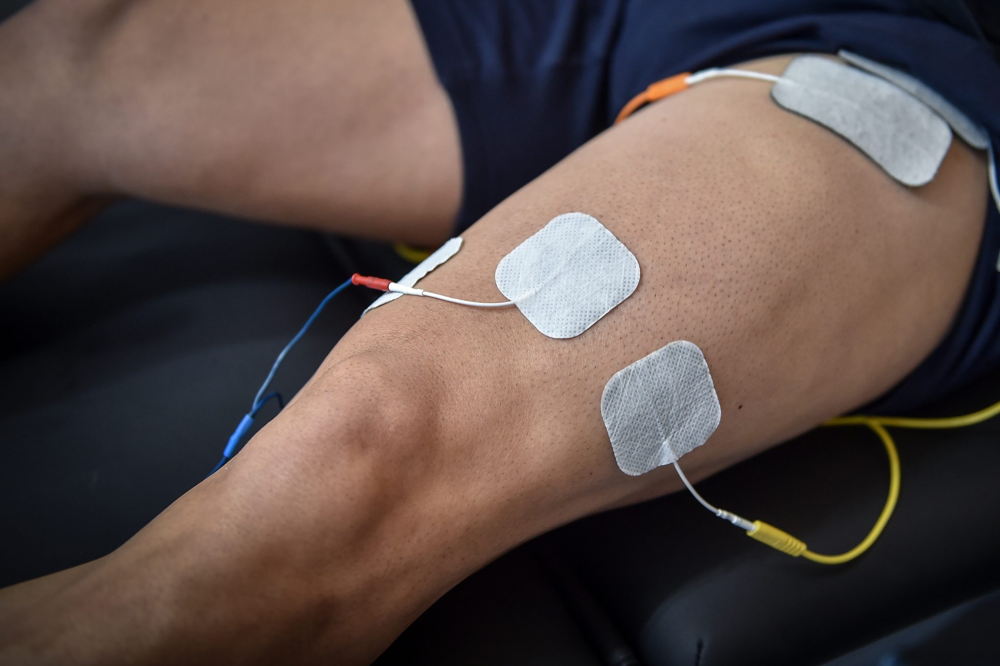 Electrical Stimulation Therapy - Alliance Physical Therapy Partners